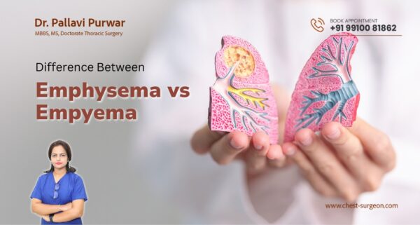 Emphysema vs Empyema: Understanding the Differences for Better Health ...